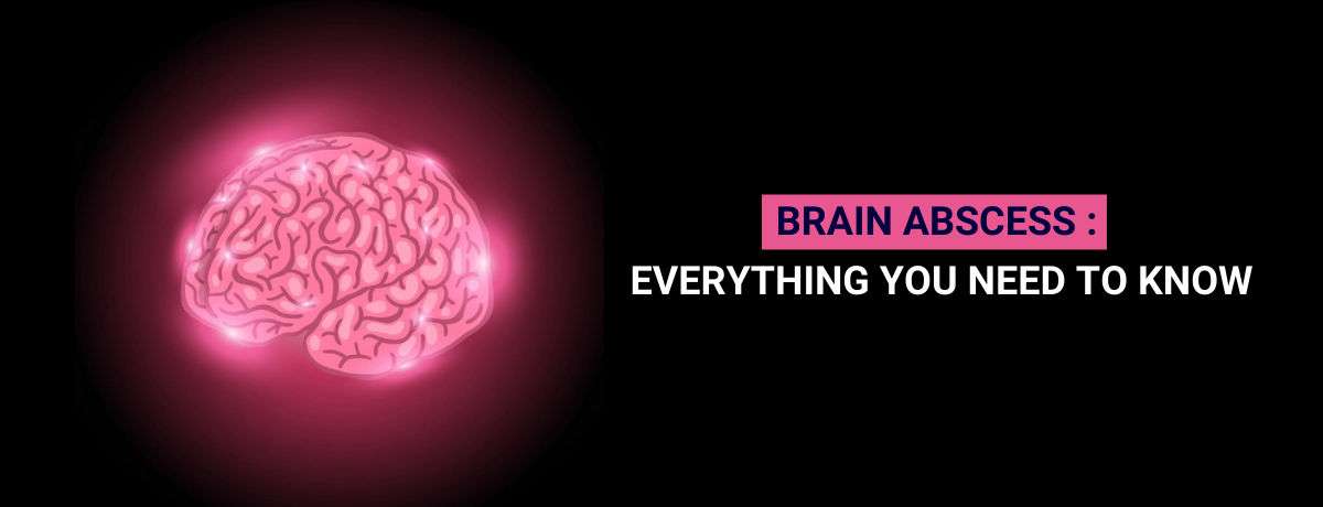 Brain Abscess – Everything You Need To Know | Dr. Gurneet Sawhney