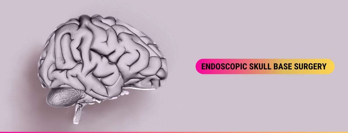 Endoscopic Skull Base Surgery | Dr. Gurneet Sawhney