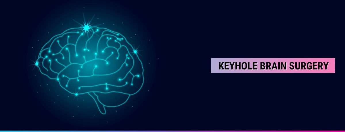 Keyhole Brain Surgery in Mumbai: Advantages & Treatment