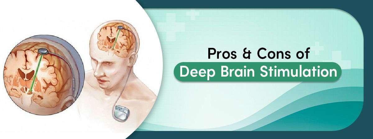 Pros And Cons Of Deep Brain Stimulation Dr Gurneet