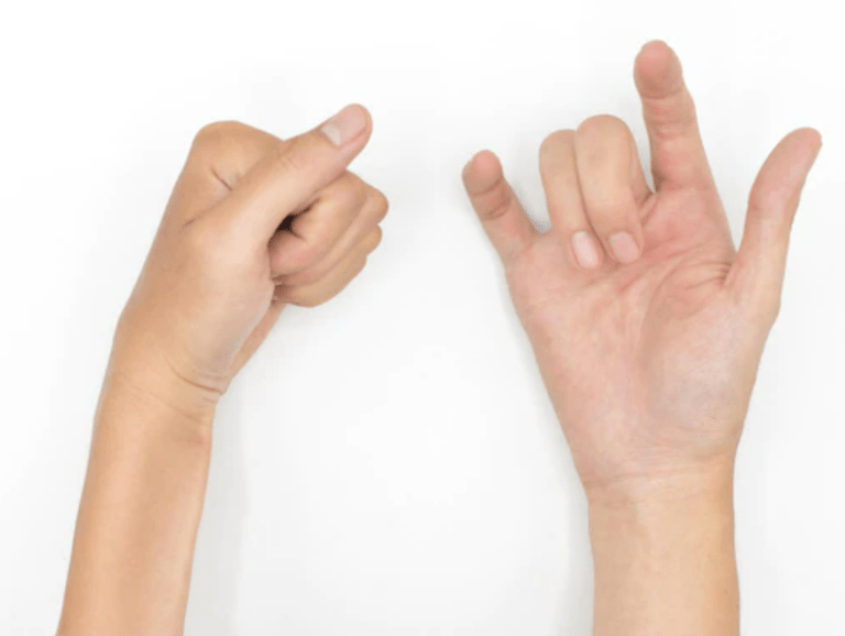 The 7 Stages of Stroke Recovery | Dr. Gurneet Singh Sawhney