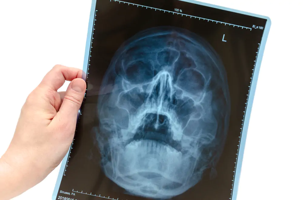 Navigating Acute Symptomatic Seizures | Dr Gurneet Sawhney