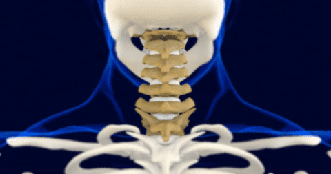 Neck Pain 1 Year After ACDF Surgery | Dr. G S Sawhney