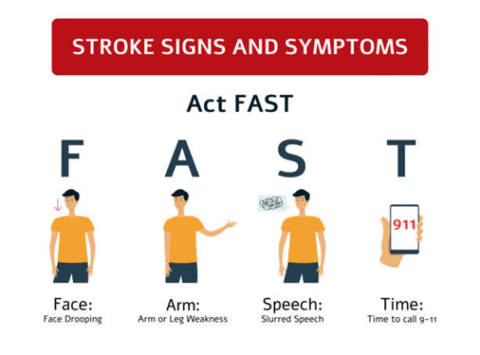 Life Expectancy After Mini Stroke at 80 – What You Need to Know