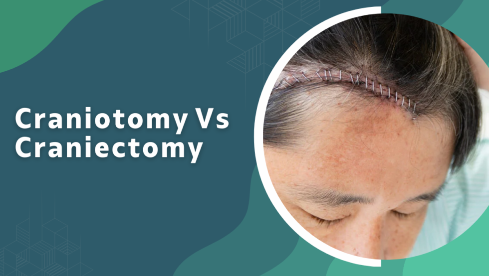 Craniotomy Vs Craniectomy: 4 Key Differences Explained by a ...